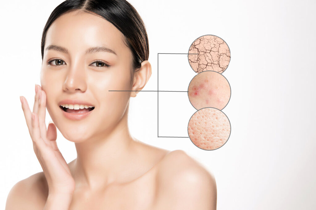 How to determine your skin type? – V Medi Aesthetics Skincare