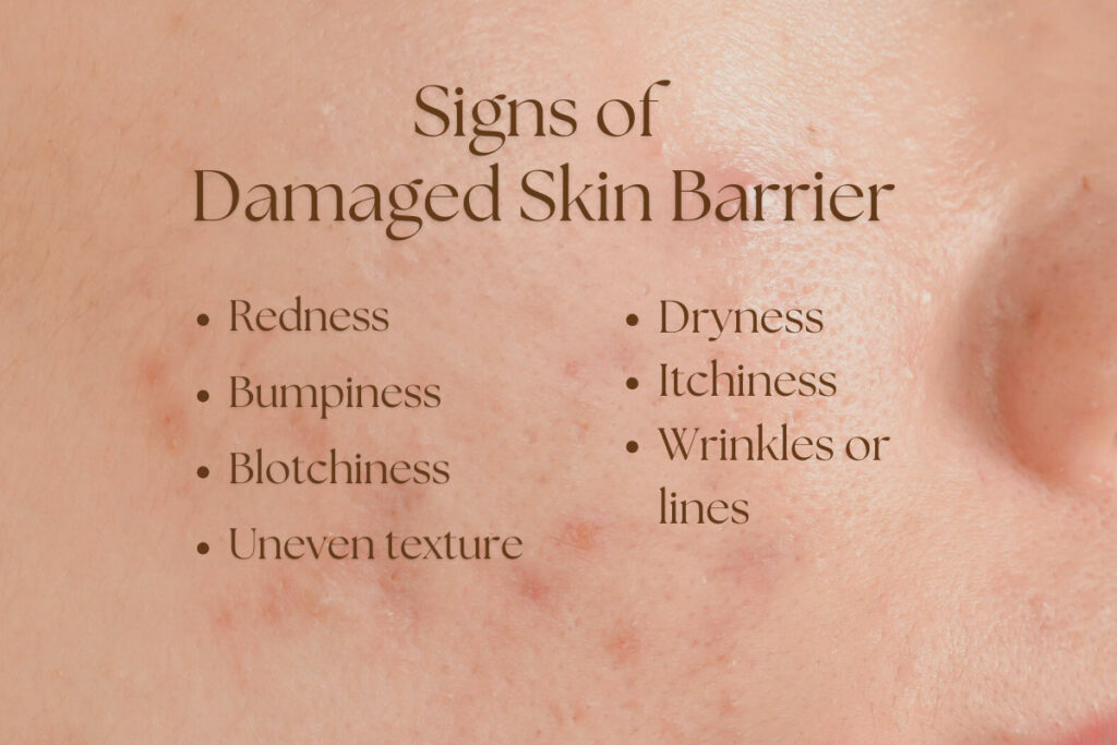 Ultimate guide to repairing your skin barrier – V Medi Aesthetics Skincare Ultimate guide to repairing your skin barrier – V Medi Aesthetics Skincare
